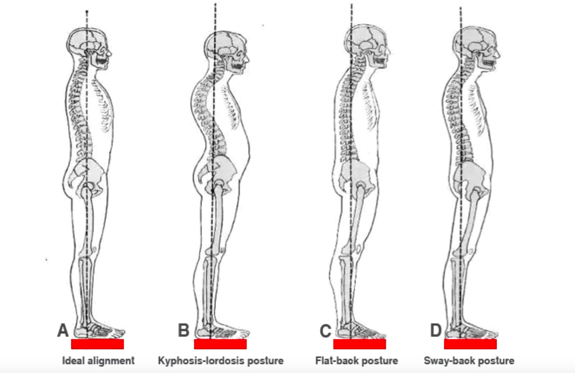 Episode 34: Back pain | phemcast